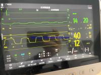 China Mindray BeneVision N Series Patient Monitor AG+O2 Module Anesthesia Gas Module, End-Expiratory Carbon Dioxide Module, for sale