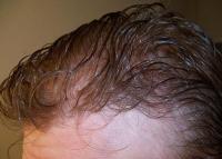 China 100% Human Hair Men'S Toupee For Natural Hairline Transformation for sale