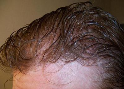China 100% Human Hair Men'S Toupee For Natural Hairline Transformation for sale