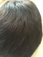 China Custom Hair Replacement Systems 12