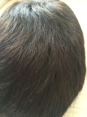 China Custom Hair Replacement Systems 12