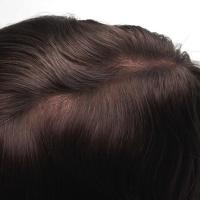 China Medium Brown French Lace Stock Hair System 9x11 Heavy Density Hair Replacement for sale