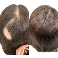 China 150g 10A Virgin Human Hair Topper Women Middle Part Hair Replacement 16 Inch for sale