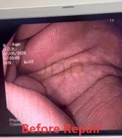China OLYMPUS CF-H180AL Electronic Colonoscope For Repair for sale