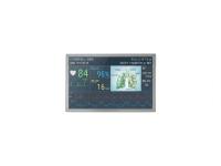 China 12.1 Inch IPS 1280×800 1000nits Medical TFT LCD Touch Display Module for sale