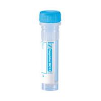 China Sodium Citrate Vial Bottle Clotted Blood Collection Edta Plasma Tube for sale