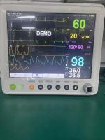 China Portable Patient Monitor With Parameters Of ETCO2 ECG NIBP SPO2 RESP TEMP PR for sale