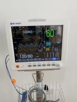 China 12 Inch Medical ECG Monitor Vital Signs Monitor For Hospital Use Factory Manufacturer for sale