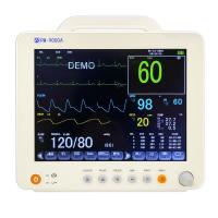 China Electric Hospital Monitor with Built-in Battery Patient Display Metal Material for sale