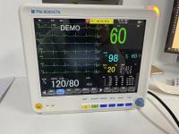 China Portable Bedside Monitor with ECG SPO2 NIBP TEMP RESP Optional ETCO2-Class II  1-Year Warranty for sale