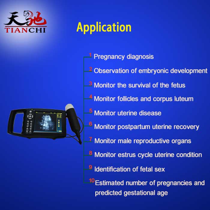 TIANCHI TC-210 Ultrasound Scan Machine Price In Thailand