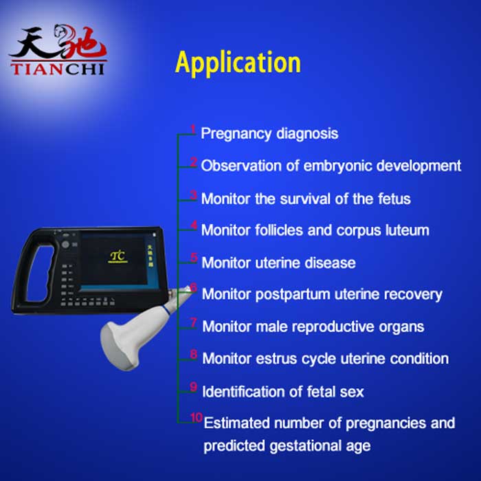 TIANCHI TC-302 Handheld Ultrasound Machine Price In Norway