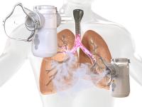 China Portable Vibrating Mesh Inhaler Battery and DC 5V USB Powered for Medical Treatment for sale