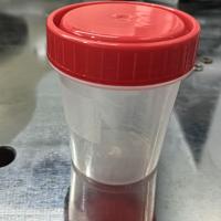 China Automatic Urine Cup Assembly Machine with 99% Qualified Rate 2500-10000pcs/hr Easy to Use Operation for sale