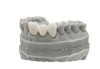 China Dental Zirconia Block optimized for anterior restorations with natural esthetic layering and compatibility with CAD CAM dental systems for sale
