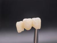 China Dental Zirconia Block preshaded for CADCAM processing with superior strength and translucency closely mimicking natural teeth for sale