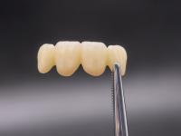 China Dental Zirconia Block Offering Advanced Gradient Design and Chemical Stability for Performance in Precision CAD CAM Dental Fabrication for sale