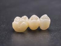 China Dental Zirconia Block Offering Advanced Gradient Design and Chemical Stability for Performance in Precision CAD CAM Dental Fabrication for sale