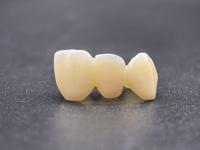 China Dental Zirconia Block Offering Advanced Gradient Design and Chemical Stability for Performance in Precision CAD CAM Dental Fabrication for sale