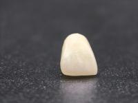 China Dental Zirconia Block Offering Advanced Gradient Design and Chemical Stability for Performance in Precision CAD CAM Dental Fabrication for sale