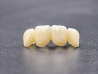 China Dental Zirconia Block Offering Advanced Gradient Design and Chemical Stability for Performance in Precision CAD CAM Dental Fabrication for sale