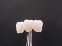 China Dental Zirconia Block compatible with CAD CAM systems providing multiple shades and fast processing for anterior dental restorations for sale