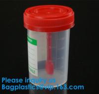 China Urine Container, Disposable Urine Collector Urine Specimen Container,Urine Specimen Cup,Sterile or Non Sterile for sale