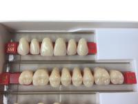 China Acrylic Resin Denture Teeth Set Repair Surfaces 2 Layers Super Hard Synthetic Dental Teeth for sale