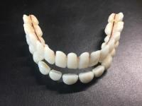 China Denture Repair Dental Acrylic Resin Teeth Kit Artificial Synthetic Resin Dentition Polymer for sale