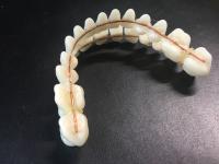 China Denture Repair Dental Acrylic Resin Teeth Kit Artificial Synthetic Resin Dentition Polymer for sale