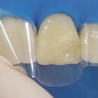 China Anterior Matrix Strips Dental Roll Dental Resin Strip Roll for sale