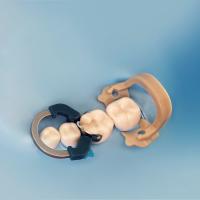 China Zt Dental Sectional Matrix System Dentistry Sectional Matrix Clamp Ring R6 1.0 for sale
