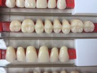 China High Wear Resistance Dental Acrylic Resin Teeth For Biocompatibility for sale