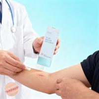 China Scarred Skin Scar Removal Gel Soothing For Dermatological Pathological Scars for sale