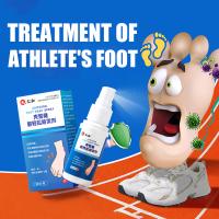 China Medical chitosan athlete's foot spray, specially formulated to treat various types of athlete's foot problems, suitable for both men and women. for sale