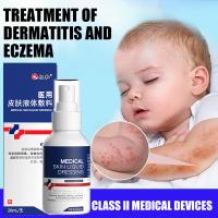 China Renhe Medical Eczema Spray. Developed specifically for eczema and dermatitis. for sale