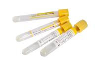 China 5mL Gel Separator Blood Collection Tube with Rapid Clotting Acceleration High-Purity Serum Yield and User-Friendly Design for sale
