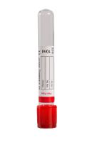 China Cancer-Specific 13×75mm Red Blood Collection Tube for Ultra-Sensitive Detection Without Clot Activator for sale