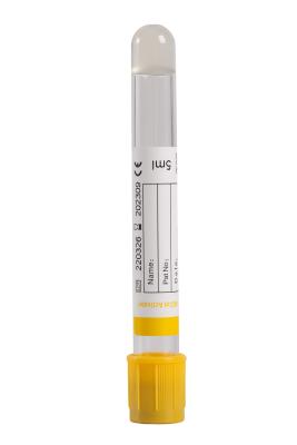 China Superior Sample Quality Vacuum Blood Test Tube Glass 5ml Reduced Sample Prep Time Customized for sale