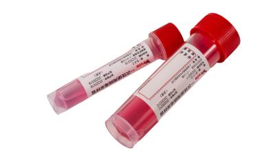 China 5ml No Additive Vacuum Blood Collection Tube with Screw Cap for Precise Sampling and Leak-proof Clinical Use for sale