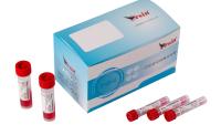 China Room Temperature Storage Non-Additive Vacuum Blood Collection Tubes With Shipping Options Of Air Or Train for sale