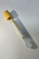 China Blood Test Tube Infectious Disease Screening Smart Separation Technology Rapid Clotting Acceleration for sale
