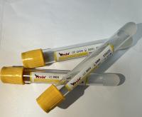 China Rapid Clotting Gel Clot Activator 5ml No Cross-Contamination Customized for sale