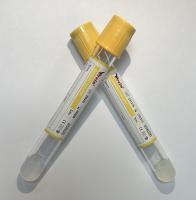 China Blood Test Tube Enhanced Serum Yield Glass Customizable Molecular Biology Immunology for sale
