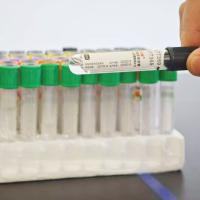 China Gray Cap EDTA Blood Collection Tube for Glucose Testing 13x75mm for sale