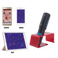 China Wireless Digital Dermatoscope Skin Microscope for Professional Diagnosis for sale