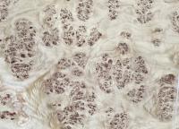 China Mappa Burl Natural Wood Veneer 0.5mm Thick Length 0.5m-3.6m for Furniture Decoration for sale
