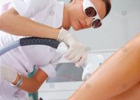 China Ce Fda Triple Wavelength Laser Hair Removal Commercial Use for sale