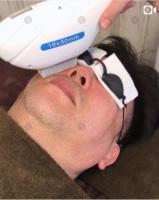 China Led Elight Ipl Machine Dpl Rf Skin Rejuvenation for sale