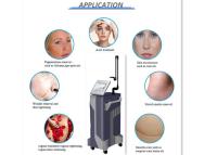 China Pigment Removal Touchscreen Co2 Fractional Laser Machine Air Cooling for sale